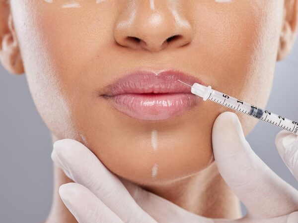 BOTOX, Dysport & Juveau - Porter Premiere Dermatology and Surgery Center